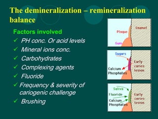 Dental Caries | PDF