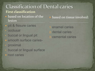 Dental caries | PPTX