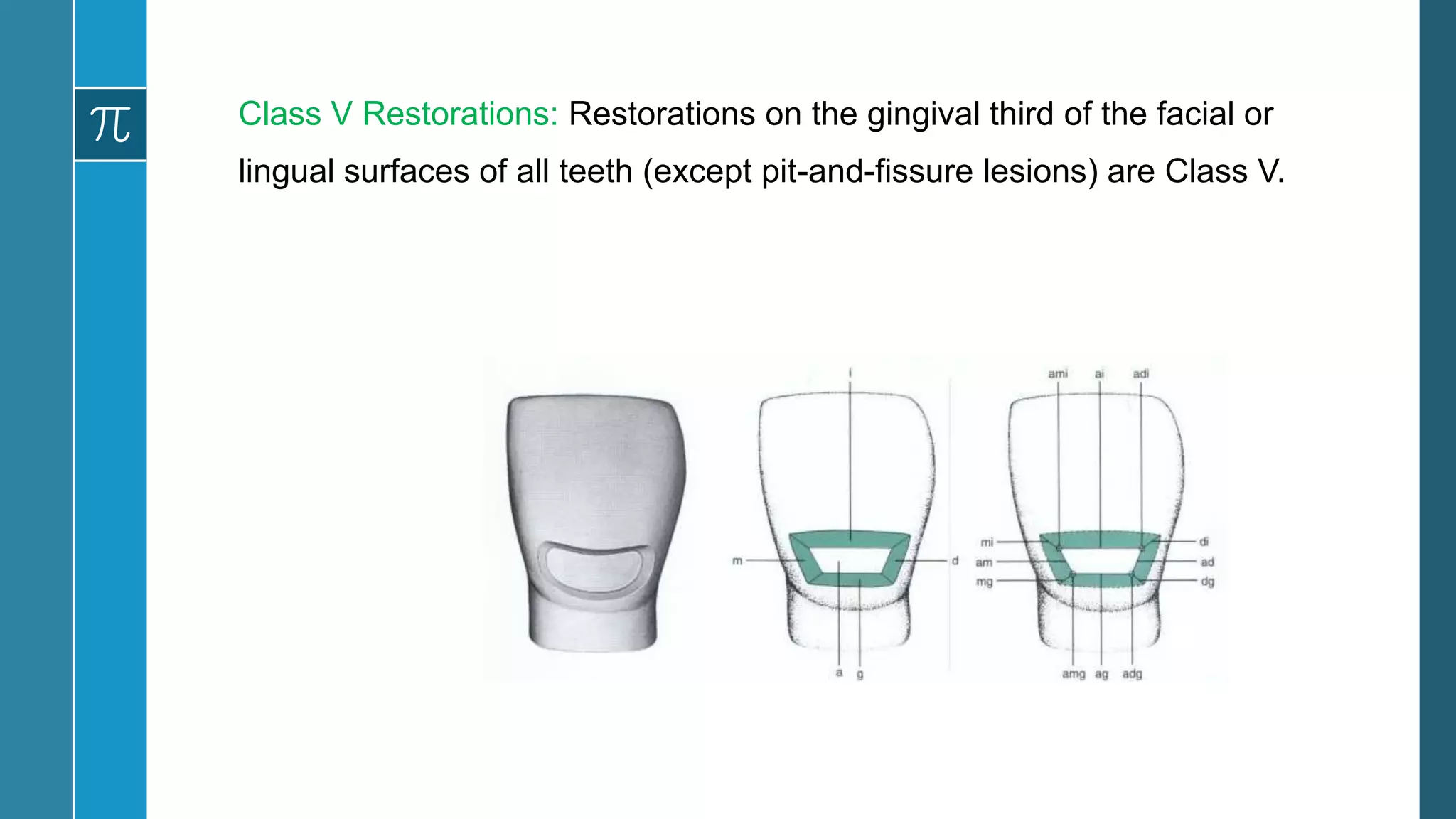 Dental caries | POTX
