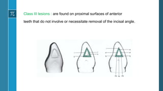 Dental caries | POTX