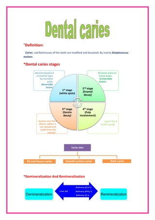 Dental caries | DOCX