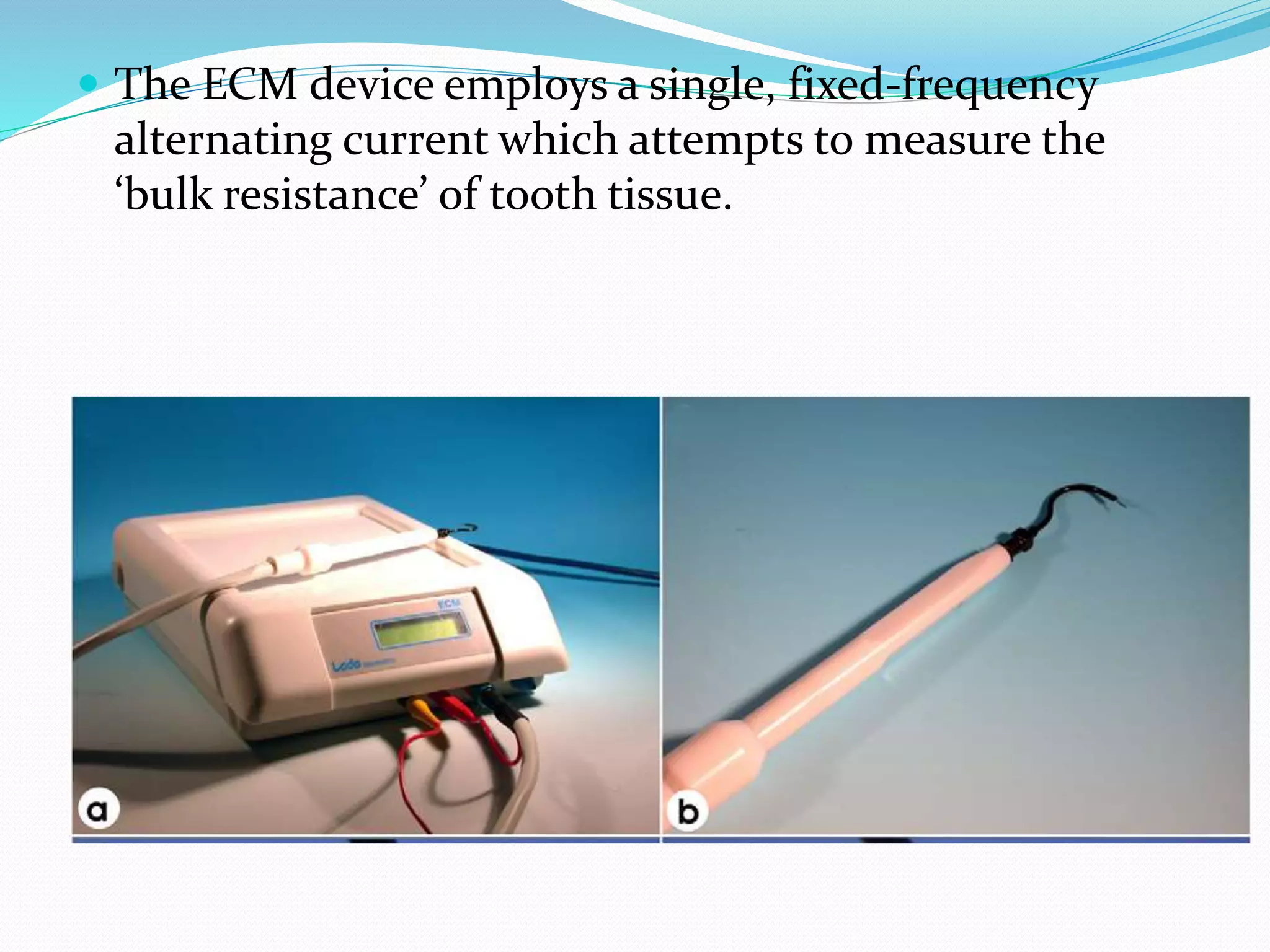 Dental caries | PPTX