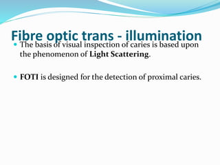 Dental caries | PPTX