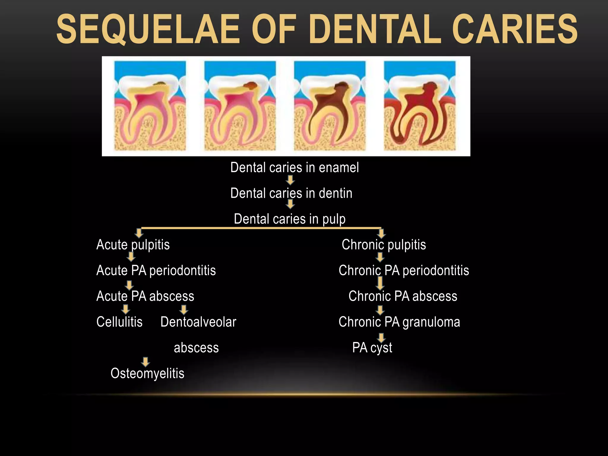 Dental caries | PPTX