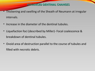 Dental Caries | PPT