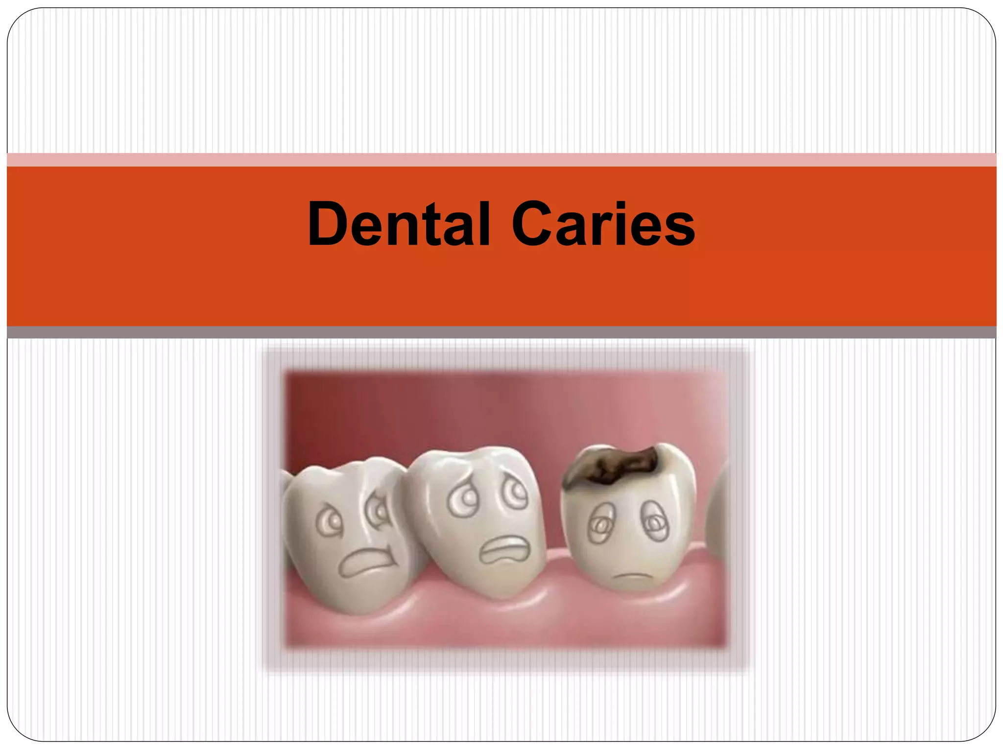 Dental caries | PPTX