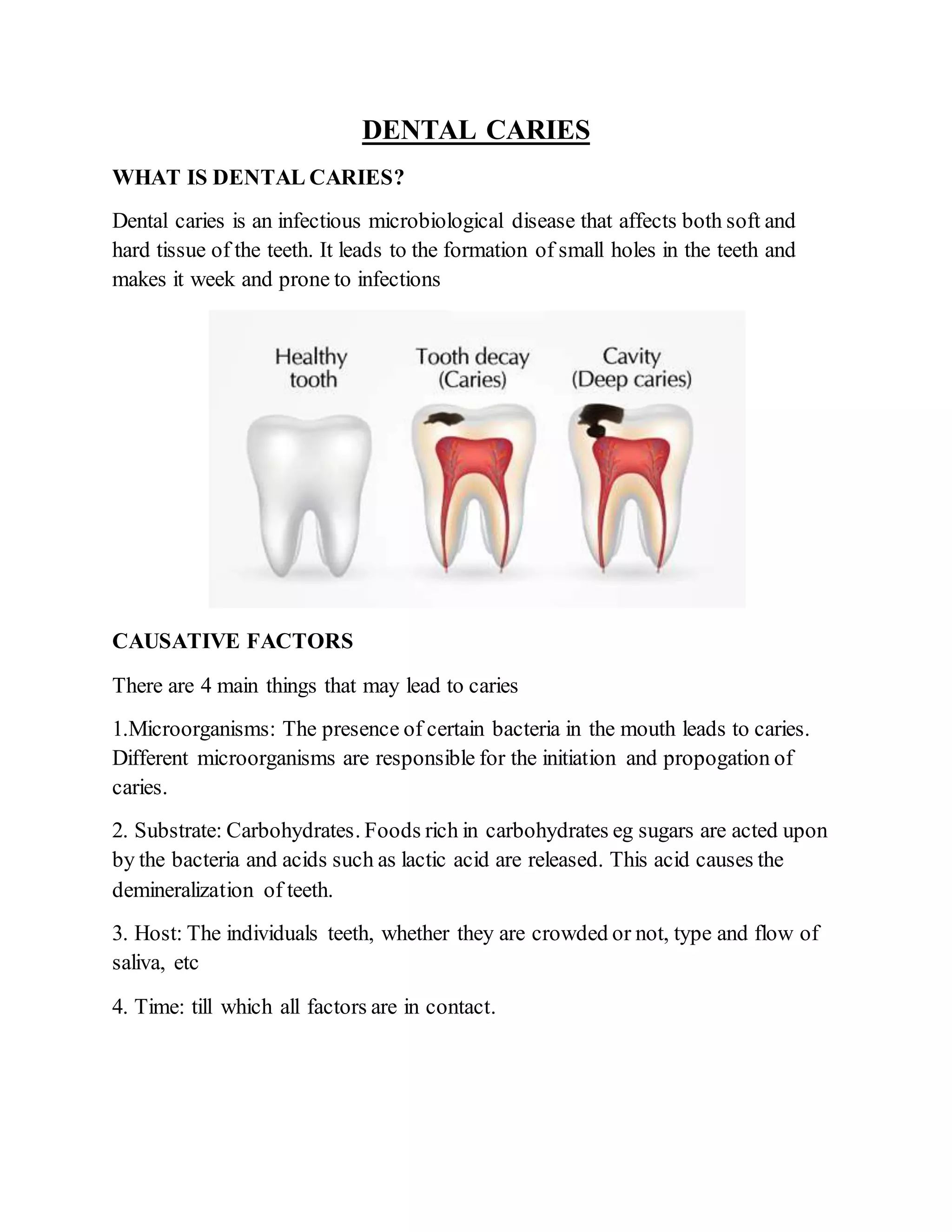 Dental caries | PDF