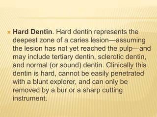 DENTAL CARIES classification, types, treatment and prognosis | PPT