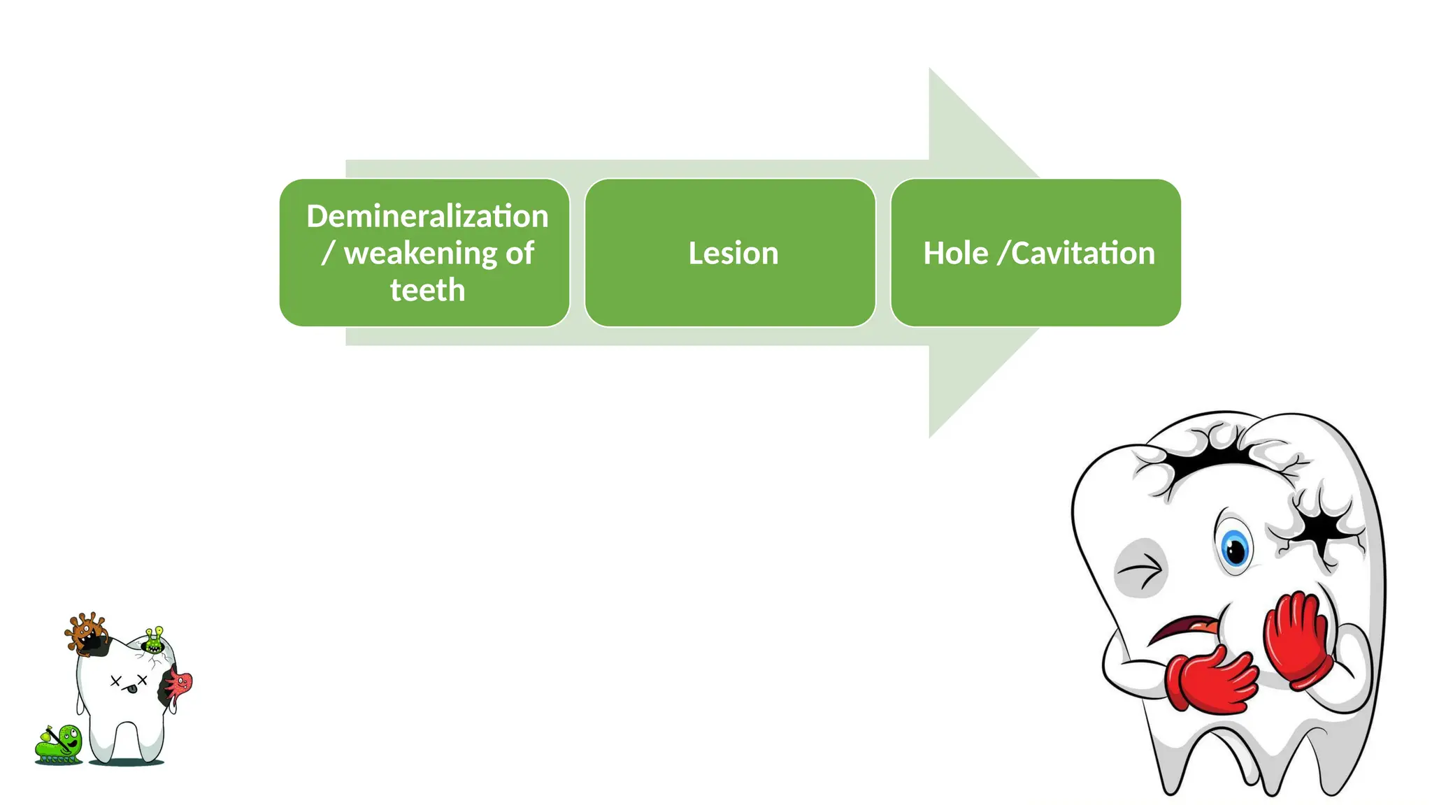 Dental Caries. It's symptoms , diagnosis & management | PPT