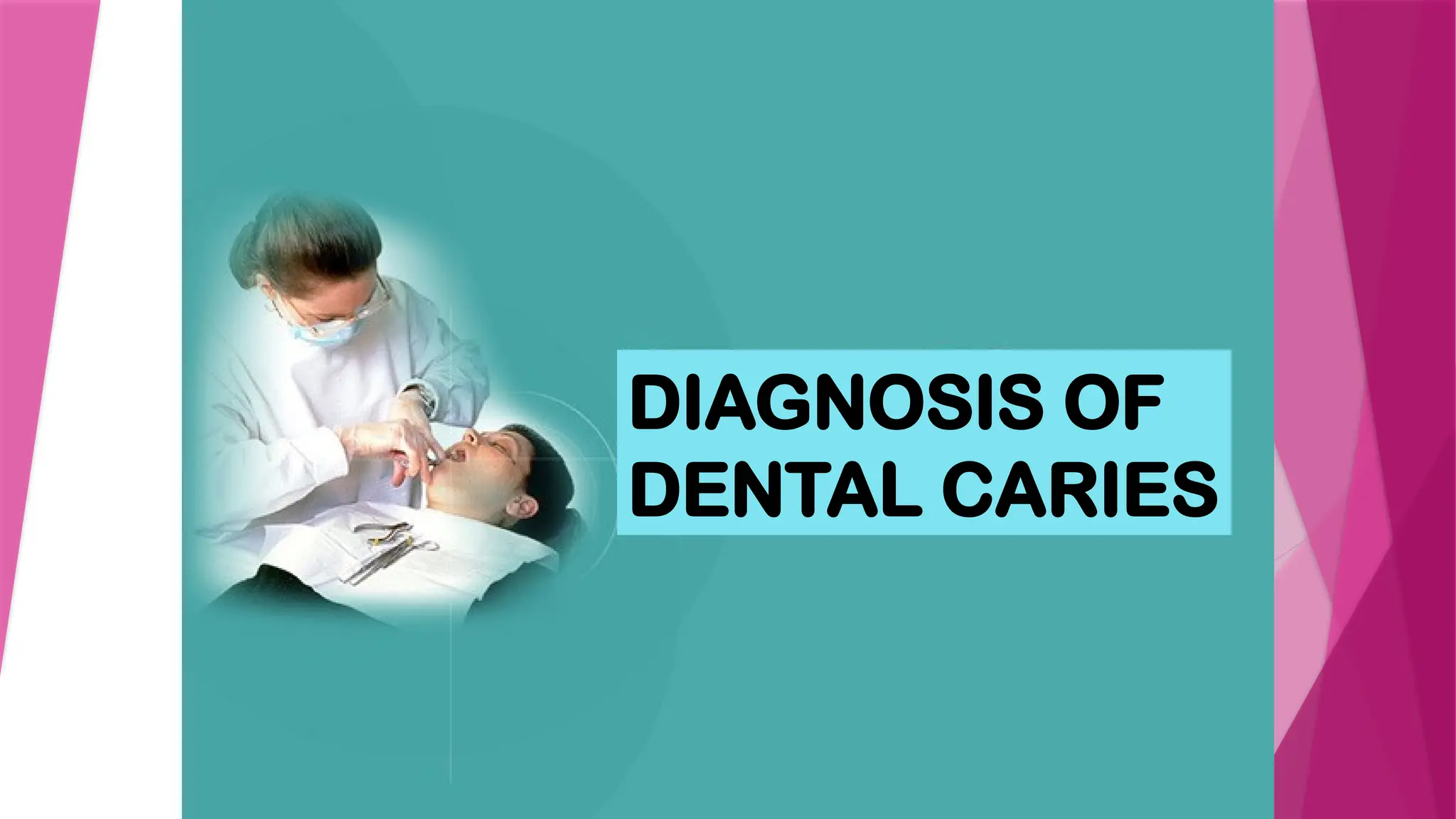 Dental Caries with classification etiology and management | PPT