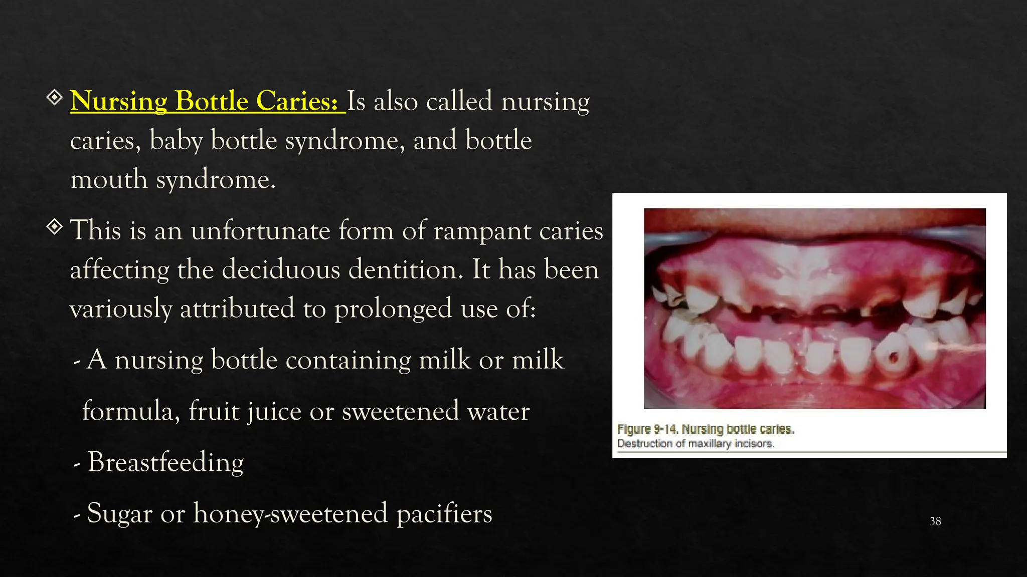 Dental caries ppt of prosthodontics(DMS) | PPT