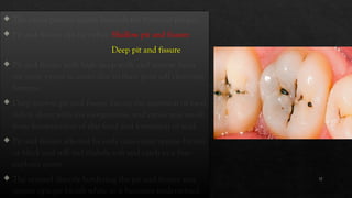 Dental caries ppt of prosthodontics(DMS) | PPTX