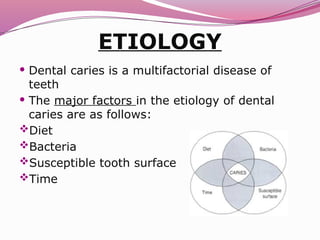Dental Caries - An introduction at the undergraduate level.pptx