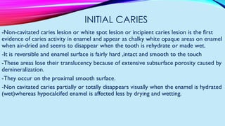 Dental Caries - Introduction, Theoriesss | PPTX