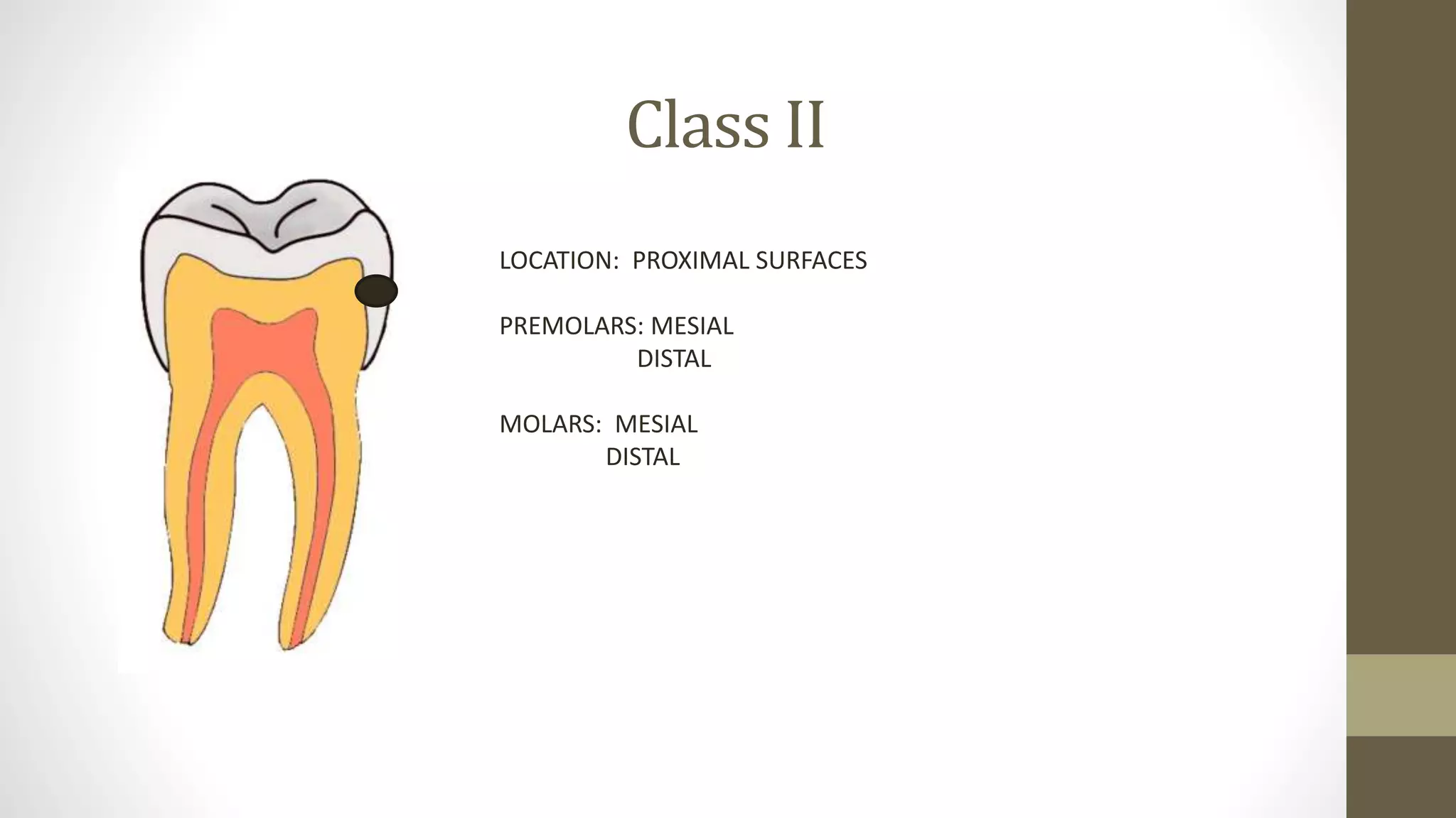 Dental caries- etiology clinical features histopathology and caries ...