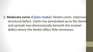 Dental caries- etiology clinical features histopathology and caries ...