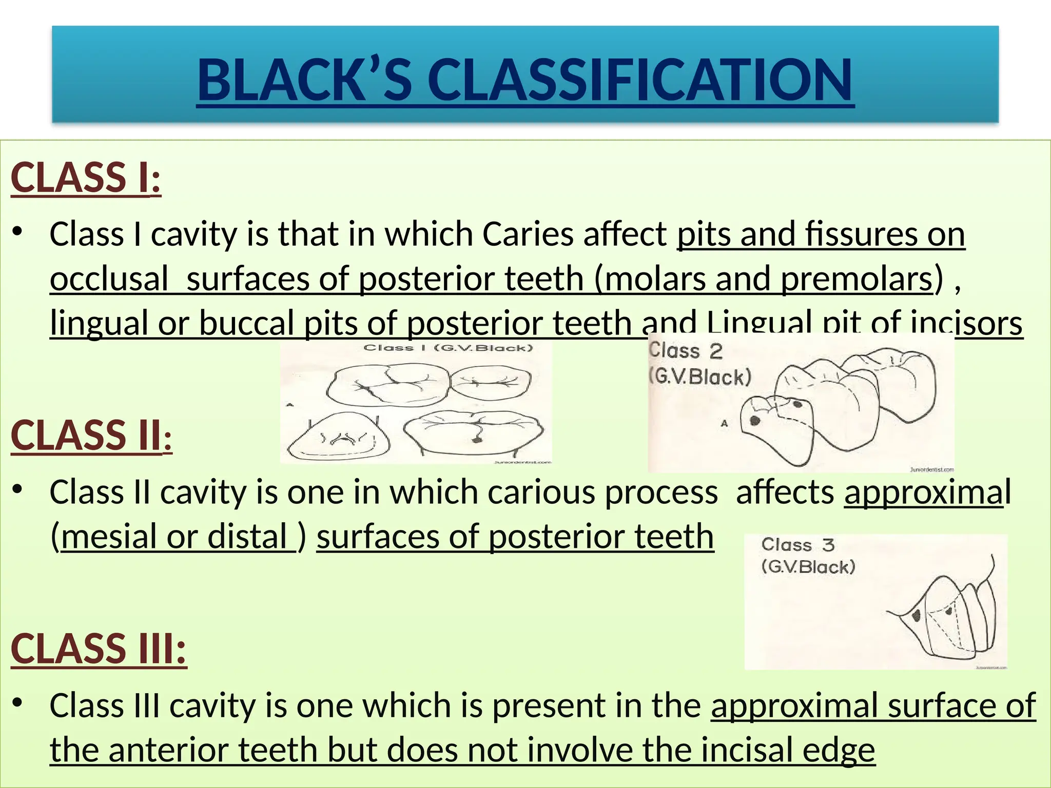 DENTAL CARIES - Classification And Theories.pptx
