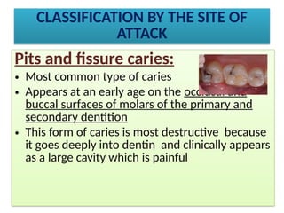 DENTAL CARIES - Classification And Theories.pptx