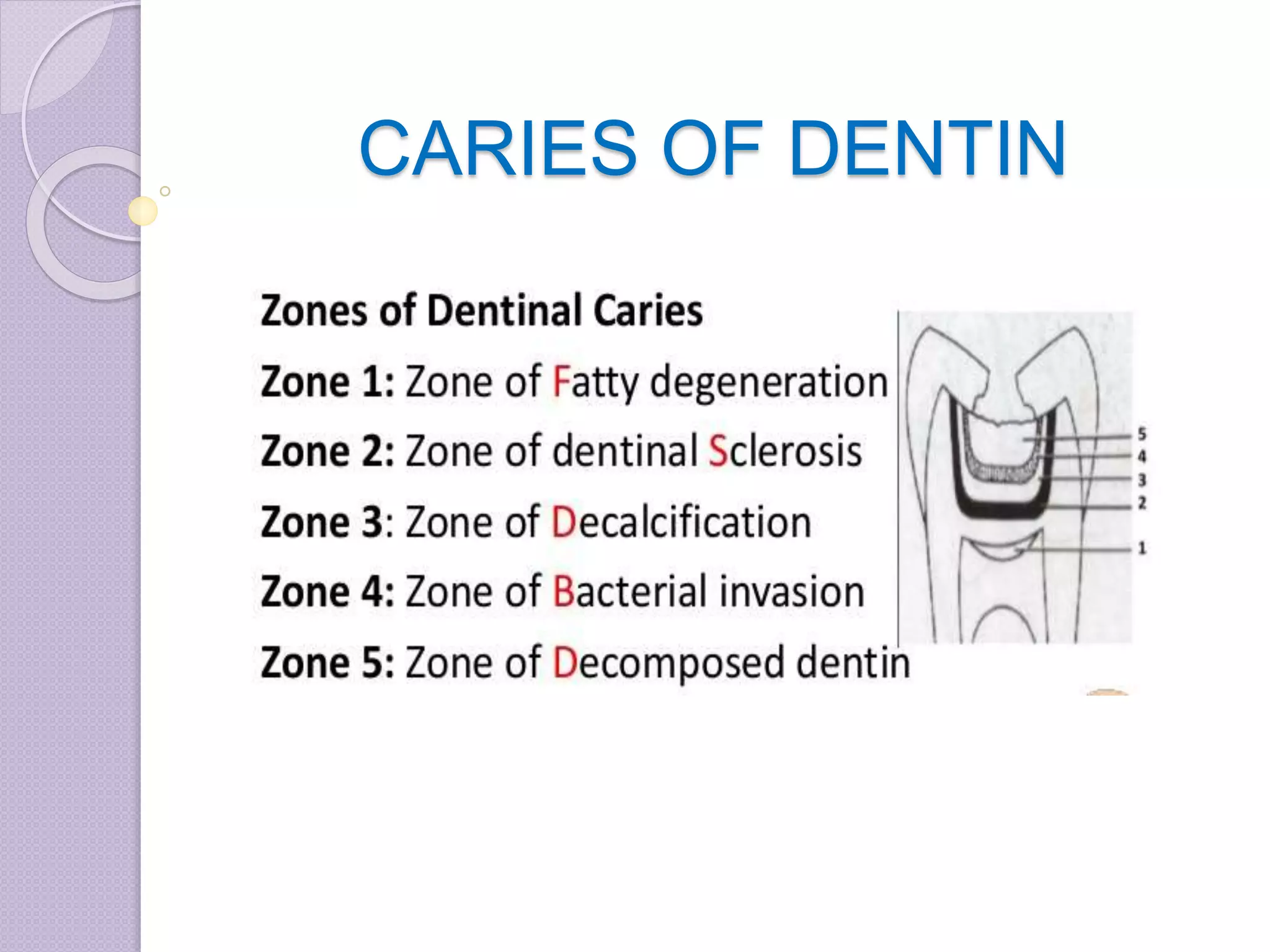 Dental caries etiopathogenesis,histopathology, diagnosis,prevention and ...