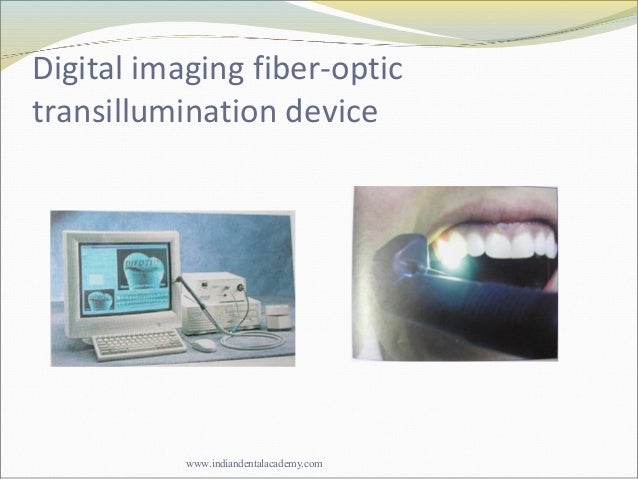 Diagnosis of Dental caries / dental implant courses