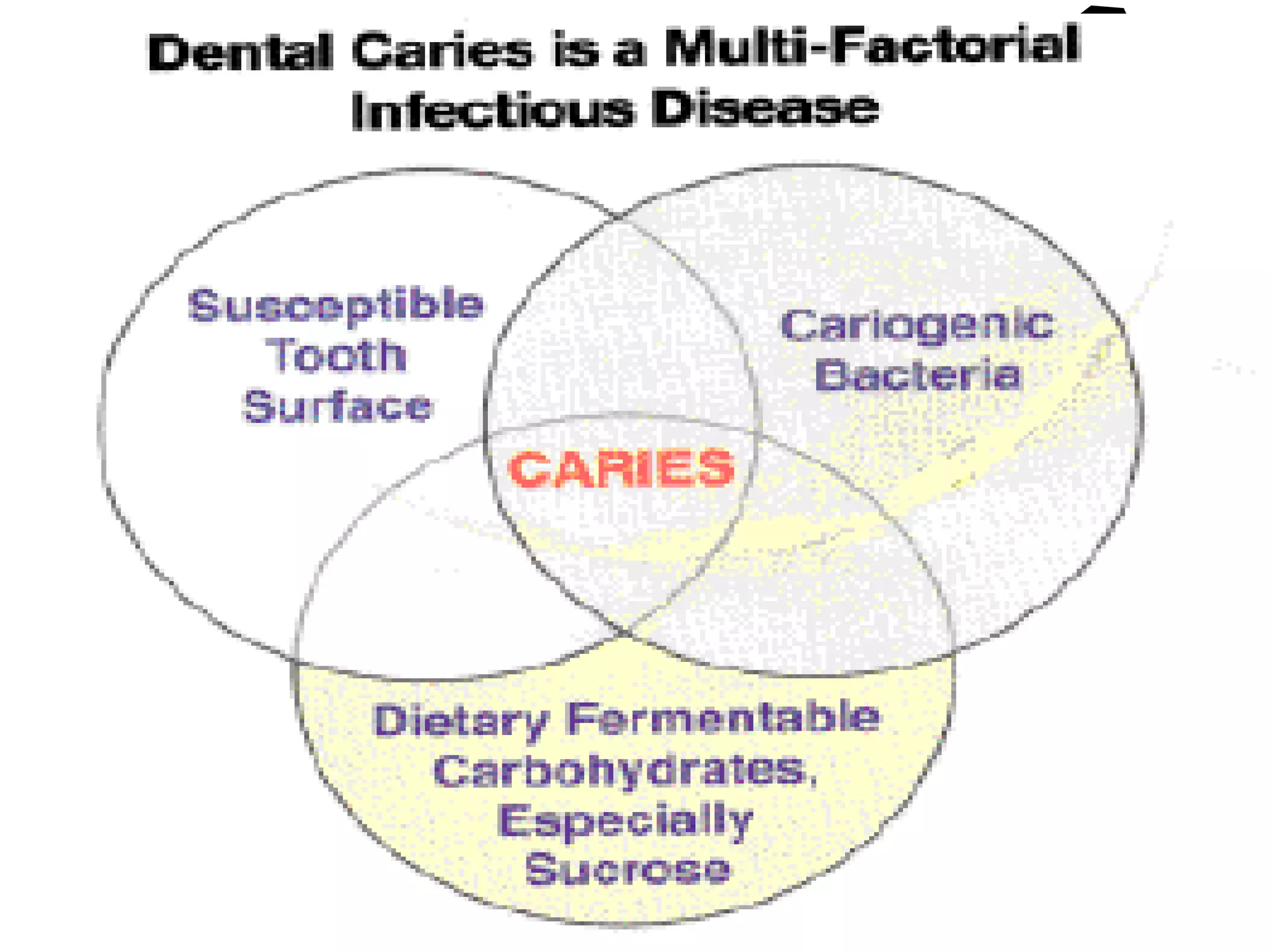 Dental caries ppt | PPT