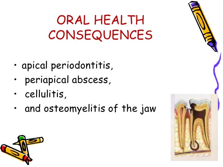 Dental caries ppt