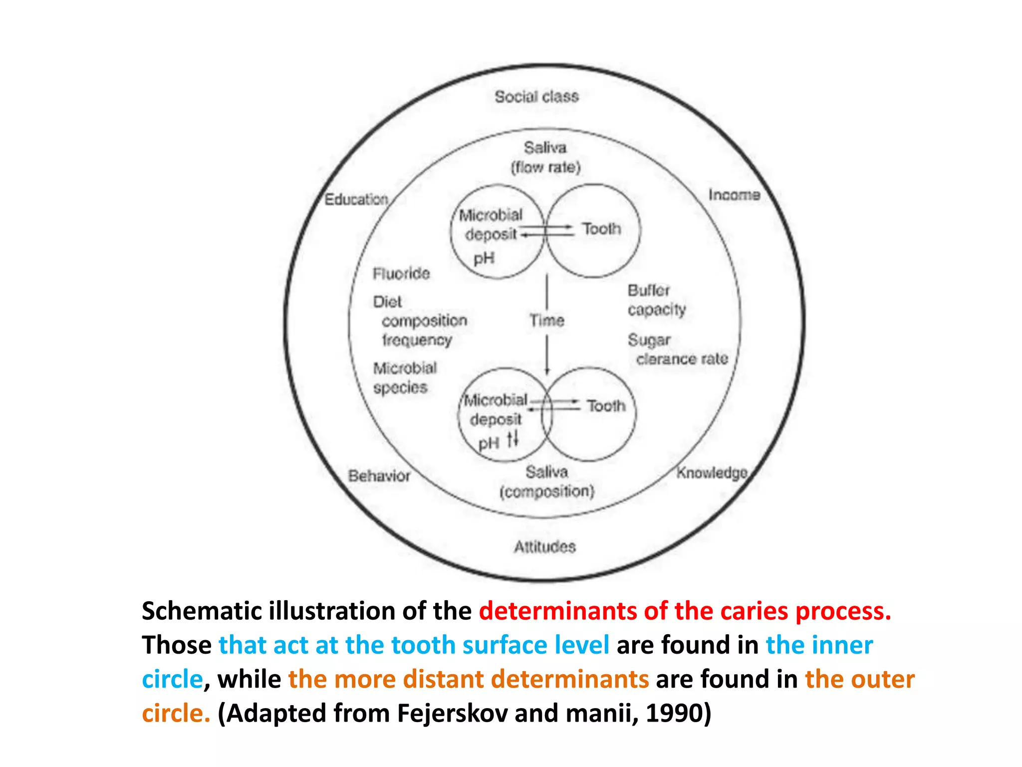 Dental Caries | PPTX