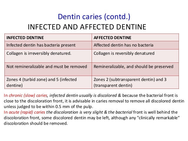 Dental Caries