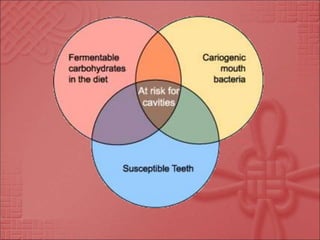 DENTAL CARIES PPT | PPT