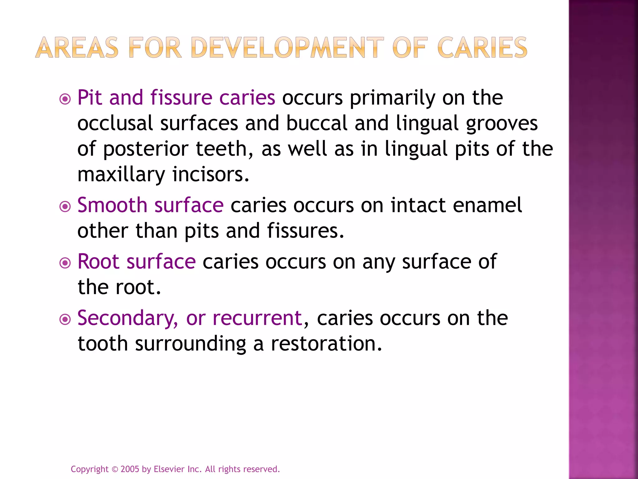 Dental caries | PPTX