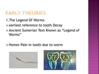 Dental caries | PPTX