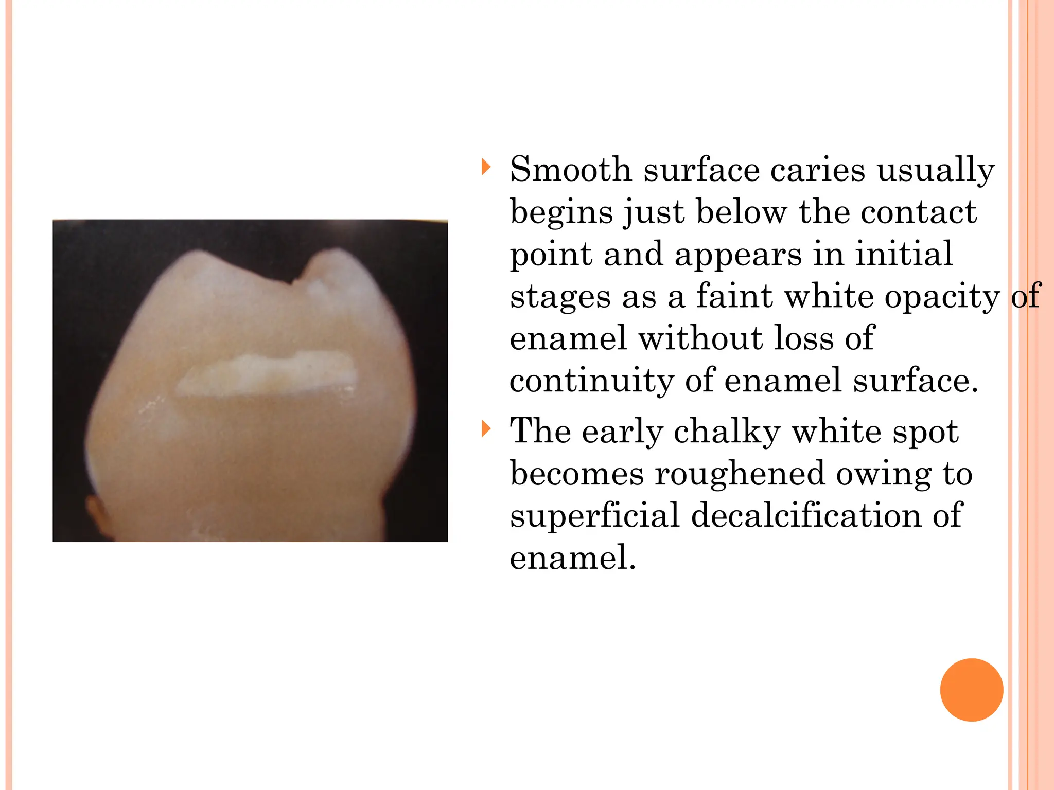 dental caries PRESENTATION DOWNLOAD FREE.ppt