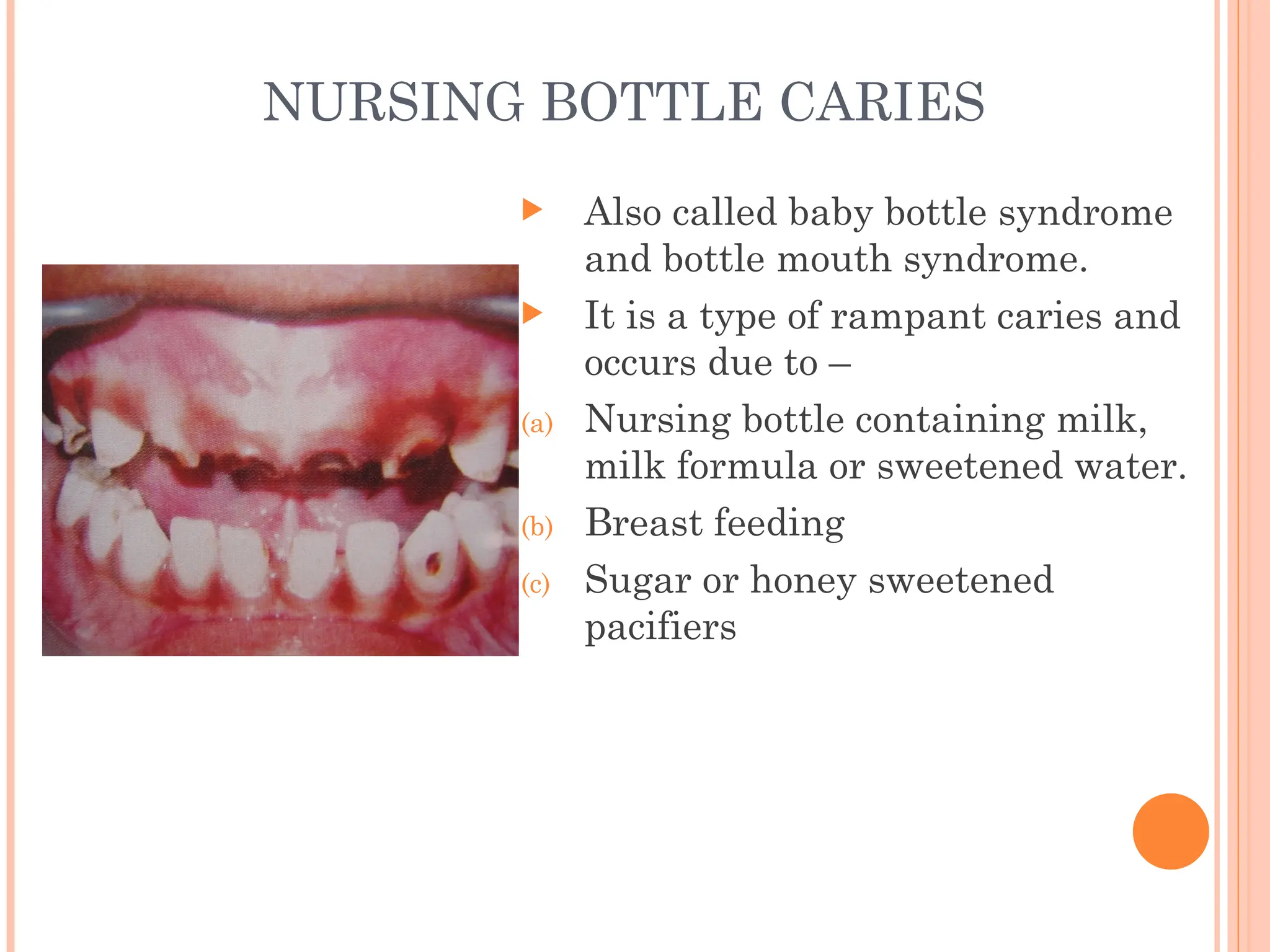 dental caries PRESENTATION DOWNLOAD FREE.ppt