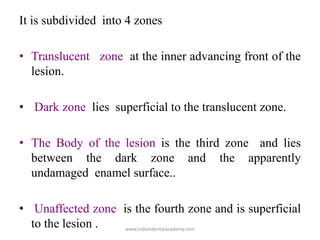Dental caries / dental implant courses by Indian dental academy | PPTX ...