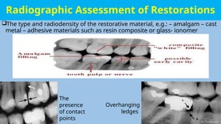 Dental caries and radiographic assessment of restoration.pptx