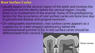 Dental caries and radiographic assessment of restoration.pptx