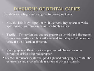Dental caries | PPT
