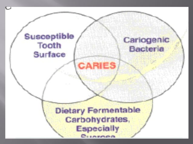 Dental caries | PPT