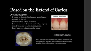 Dental Caries classification & Microbiology | PPTX