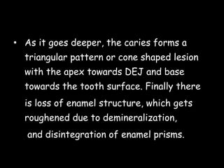 Dental_caries_hisopathology (1).pptx