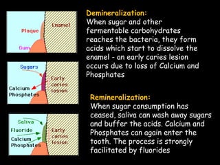 Dental_caries_hisopathology (1).pptx
