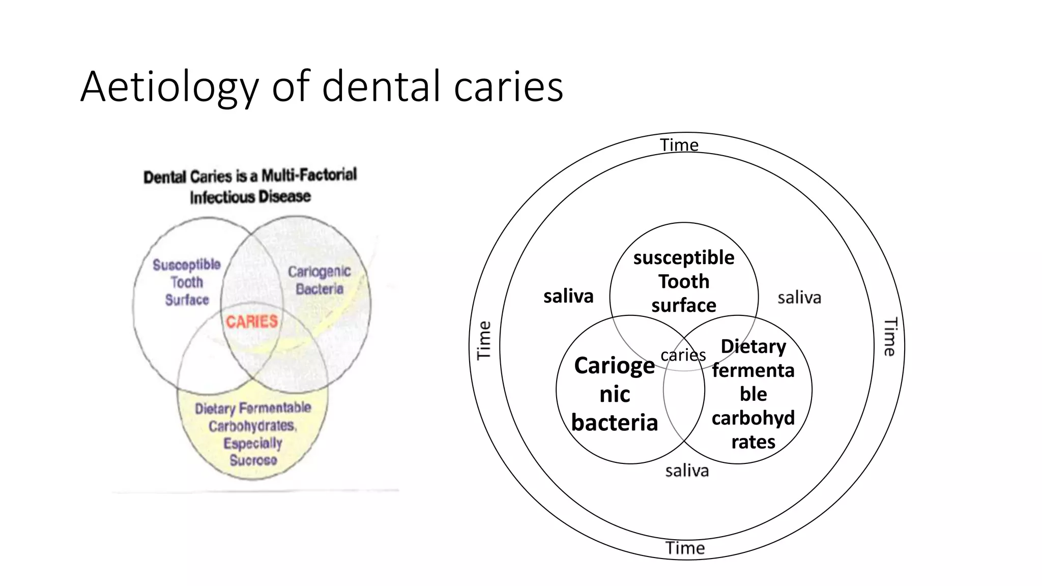 Dental caries , its etiology | PPTX