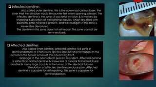 Dental caries and management | PDF