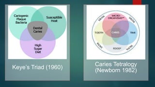 DENTAL CARIES | PPTX