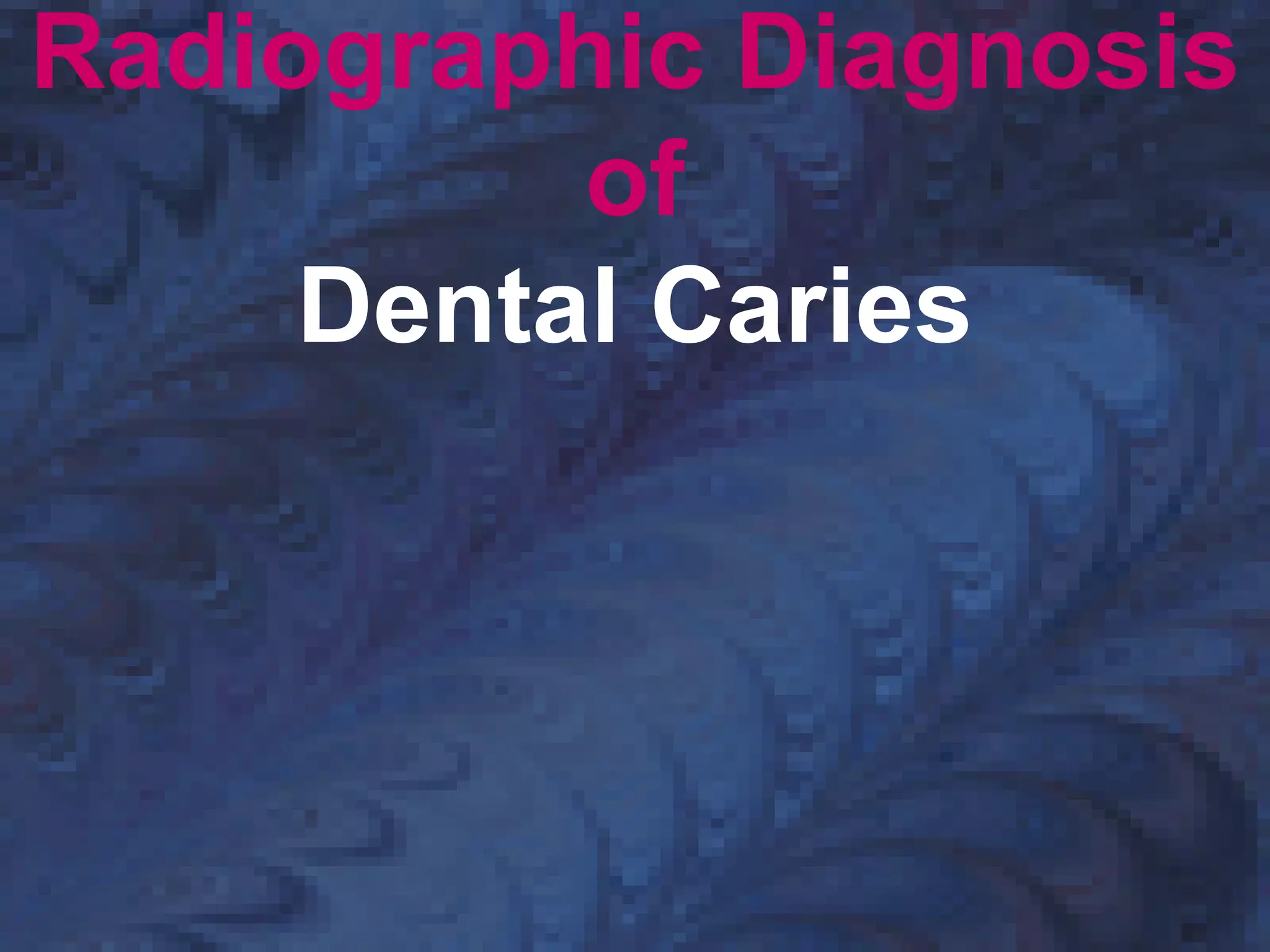 Radiographic Diagnosis of Dental Caries | PDF
