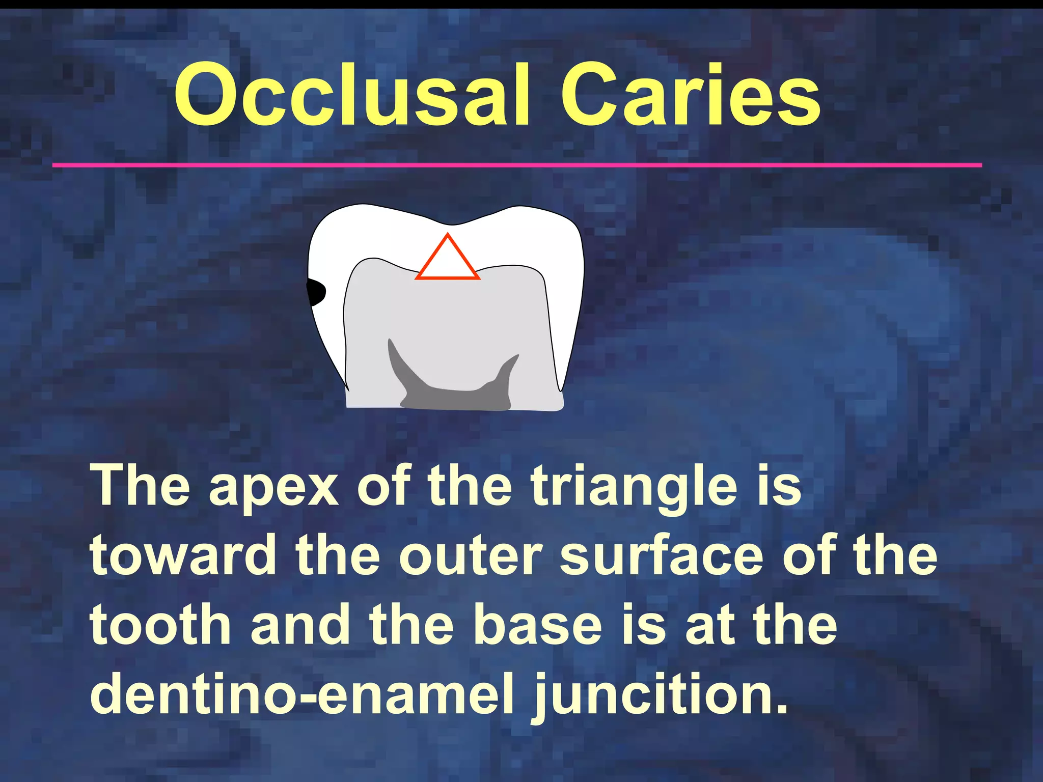 Radiographic Diagnosis of Dental Caries | PDF