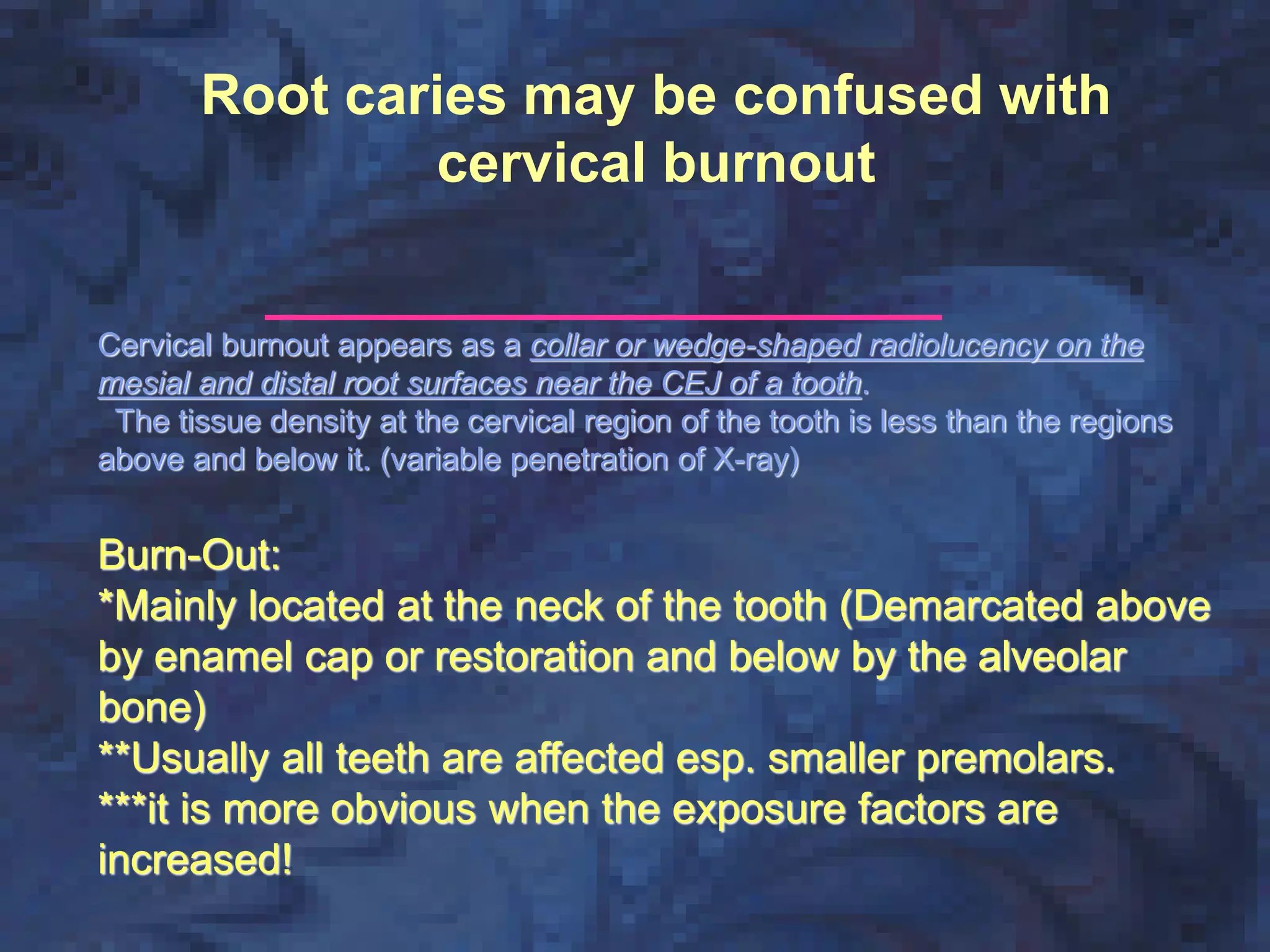 Radiographic Diagnosis of Dental Caries | PDF
