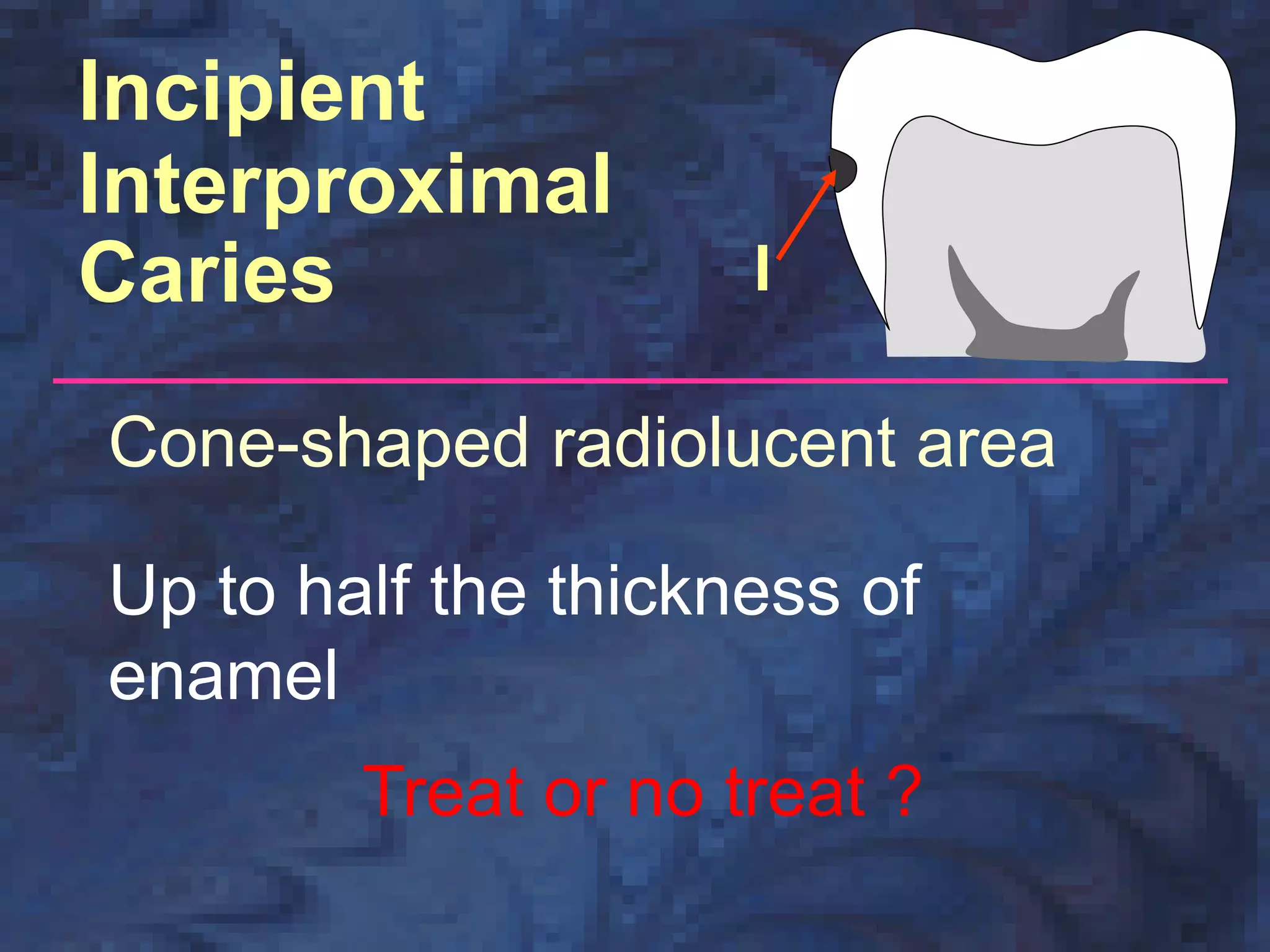Radiographic Diagnosis of Dental Caries | PDF