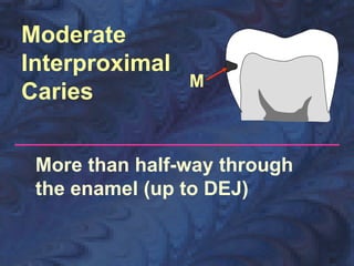 Radiographic Diagnosis of Dental Caries | PDF