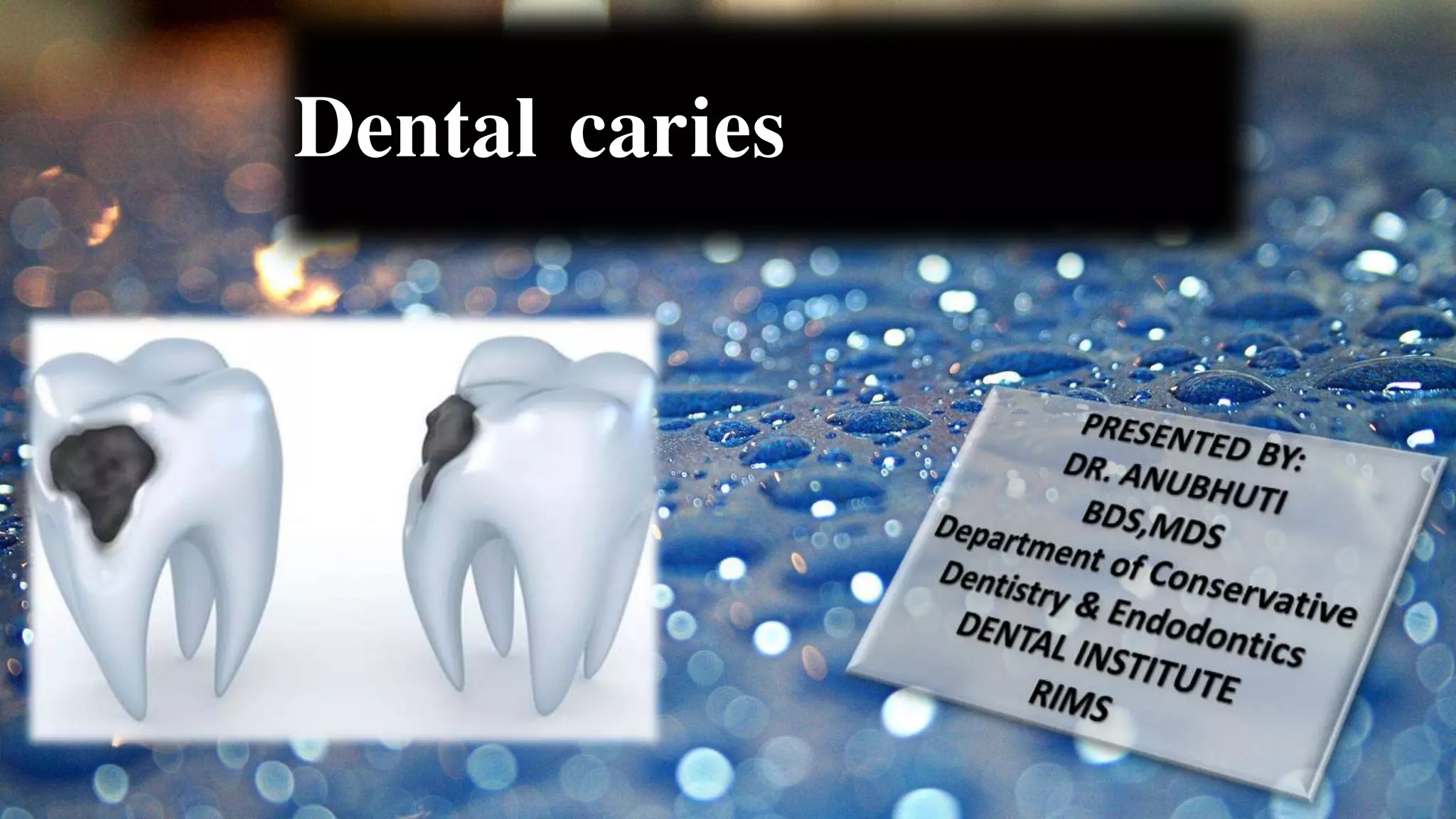 Diagnosis & treatment of Dental caries | PPTX